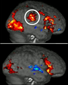 Pain in your head- Pain and psychology, how do the 2 interact
